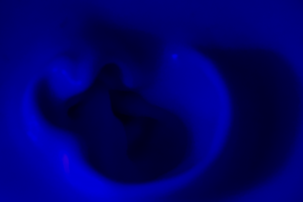 Cyron Completo – Flow Visualization